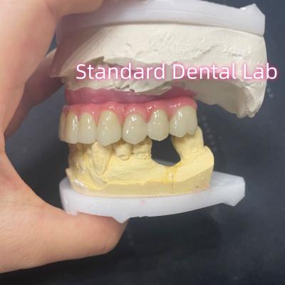 Chine Le pont Malo Hybride Zirconia Tout sur quatre / six Zirconia Implant Bridge Bar Titanium à vendre