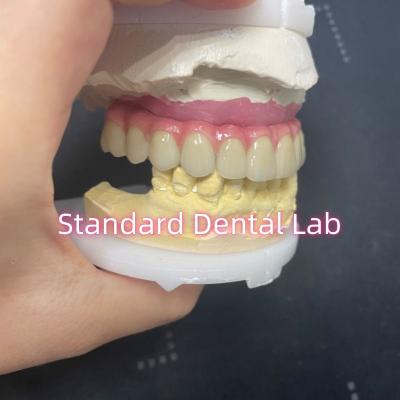 Chine Le pont Malo Hybride Zirconia Tout sur quatre / six Zirconia Implant Bridge Bar Titanium à vendre