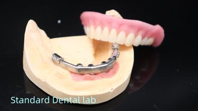 Titanium Implant Supported Dentures Precise Ivoclar Denture Over Implants