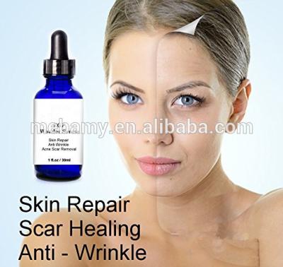 Chine Sérum de visage du retrait EGF de cicatrice d'acné de Virginiana de Hamamelis à vendre