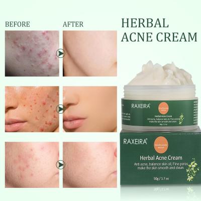 Chine Crème de visage de fines herbes de lissage de 100% et de nettoyage naturelle pour l'anti acné à vendre