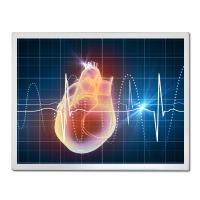 15 Inch DV150X0M-N10 TFT LCD Module 1920x1080 BOE IPS Panel 50K china 15 Inch DV150X0M-N10 TFT LCD Module 1920x1080 BOE IPS Panel 50K