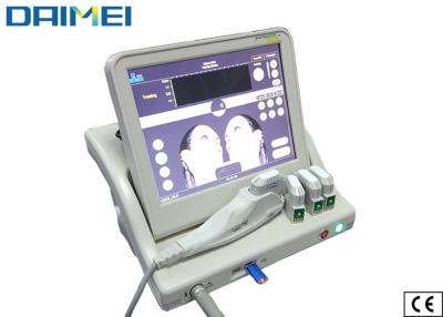 Cina Macchina non dilagante 5 di bellezza di HIFU 10000 cartucce di colpi per la stazione termale clinica/del salone in vendita