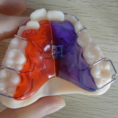 China Smooth Surface Plastic Implantation Scenarios for Customized Solutions for sale