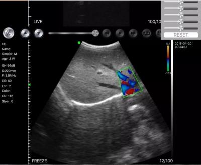 中国 超音波機械無線超音波の調査192の要素のWifiの手持ち型色ドップラー 販売のため