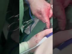 Clinic Hepatology Probe PLA408 for Open Surgery