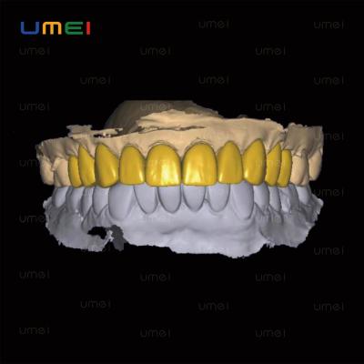 China Minimally Invasive Durable Dental Veneer Bespoke CAD Design Solutions for sale