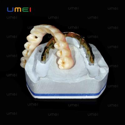 China Digital Precision Titanium Alloy Malo Bridge Dental Biocompatibility for sale
