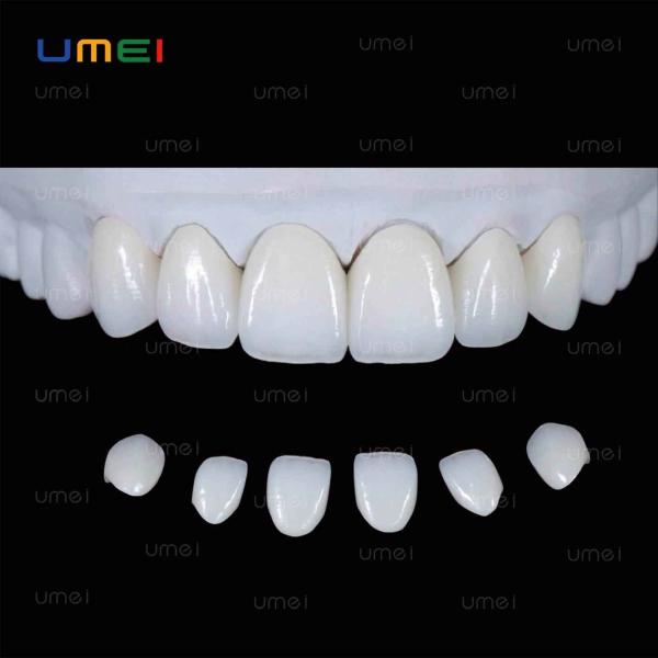 Quality Ultra Simulated Dental Zirconia Veneers Biocompatible Aesthetic Veneers for sale