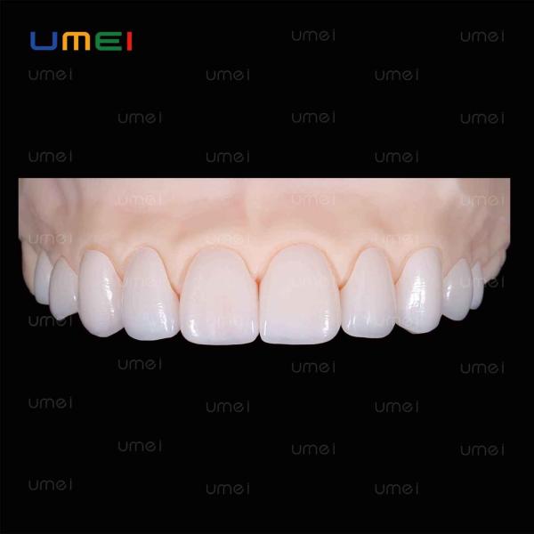 Quality Durable Whitening Porcelain Veneers , High End Transparent Dental Clinic Veneers for sale