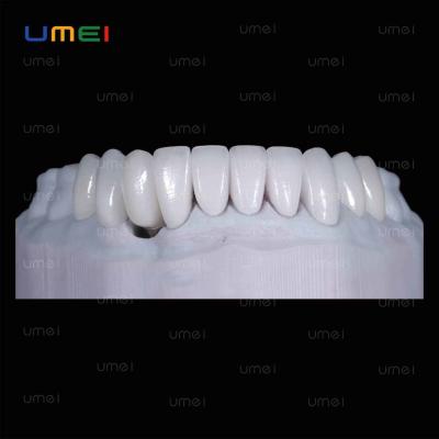 China Customized Ceramic Dental Veneers High Temperature Firing Esthetic Veneer for sale