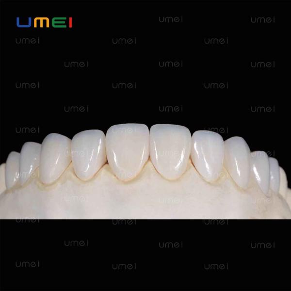 Quality Minimally Invasive Cosmetic Dentistry Porcelain Veneers Ultra Thin Wear Resistant for sale