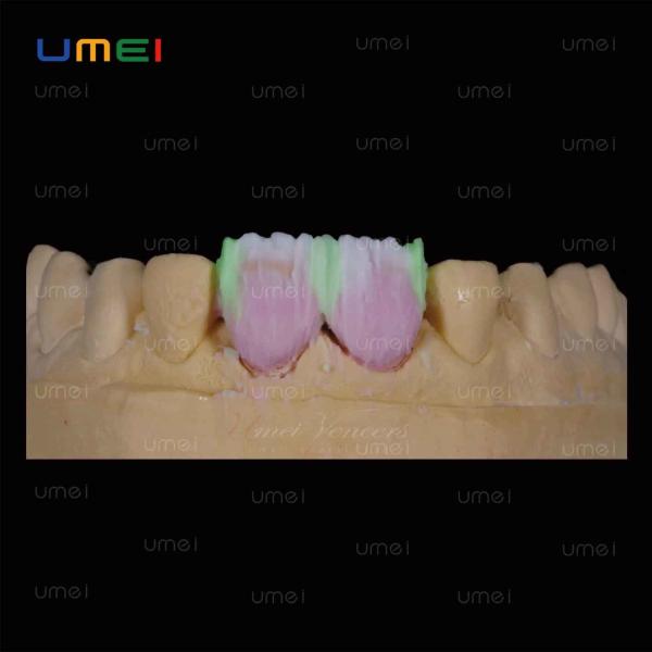 Quality Natural White Cast Porcelain Laminate Veneers , Dental Layered Emax Veneers for sale