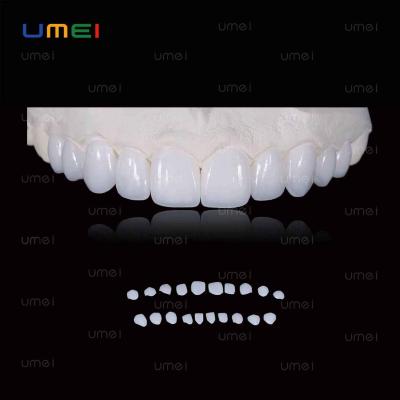 China Ultra Thin Zirconia Veneers , Unmatched Natural Aesthetic Veneers Stain Proof for sale