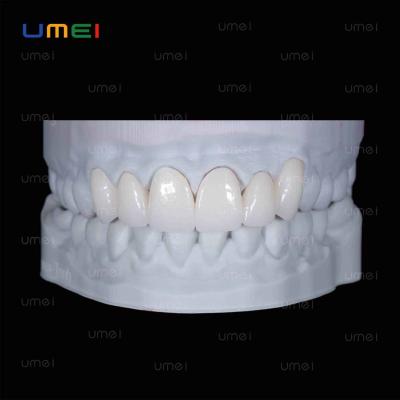 China Natural Clear Zirconia Veneers Transparent Zirconia All Ceramic Crown for sale