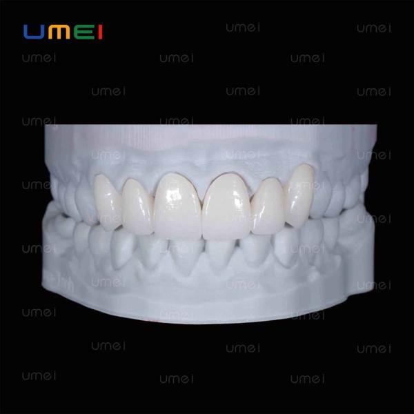 Quality Natural Clear Zirconia Veneers Transparent Zirconia All Ceramic Crown for sale