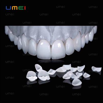 China High Strength Emax Ceramic Veneers Natural Aesthetic Hollywood White Veneers for sale