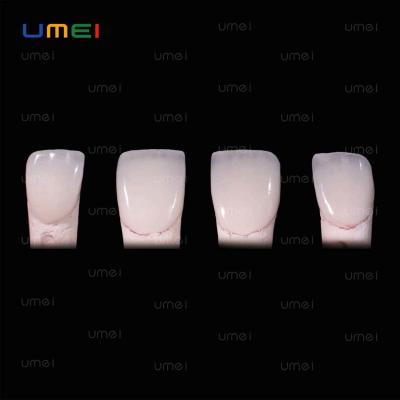China Ultra Thin Aesthetic Porcelain Veneers Stain Resistant Minimal Invasiveness for sale