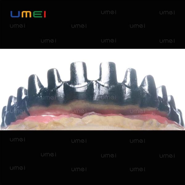 Quality Lightweight Full Arch Dental Implant Bridge Corrosion Resistant Titanium Alloy Malo Bridge Dental for sale