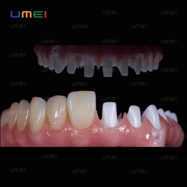 Quality High Strength Full Arch Zirconia Bridge Lightweight Aesthetic Dental Zirconia Bridge for sale