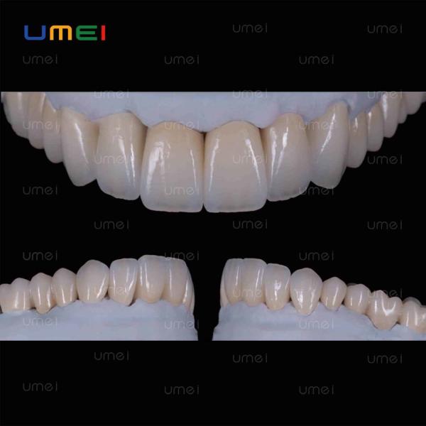 Quality High End Zirconia Crown Bridge Minimally Invasive High Hardness Dental PMMA Blocks for sale