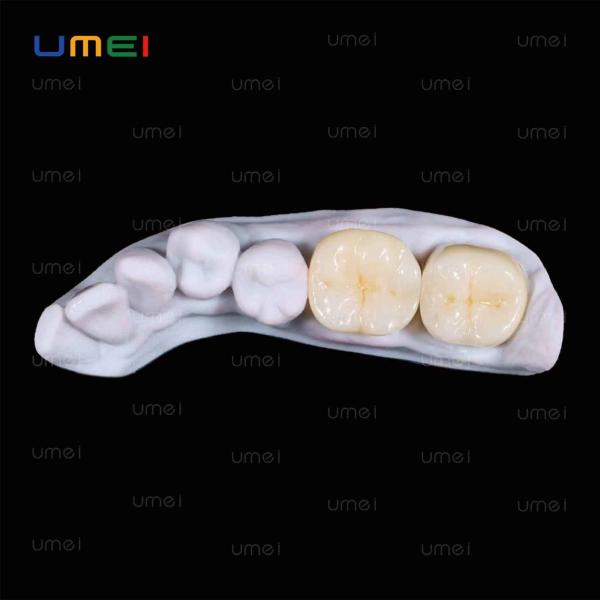 Quality All-Ceramic Dental Crowns-Bionic Aesthetic Restoration-Precision Fit Design-Biologically Safe and Friendl for sale