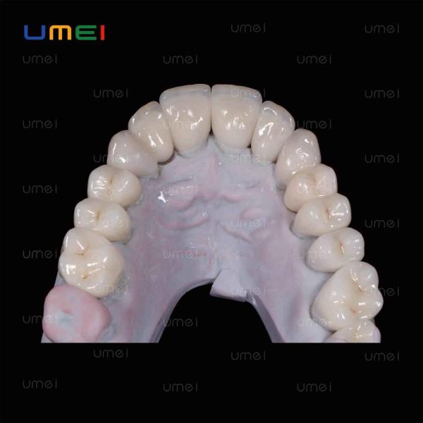Quality Zirconia Crown-Superior Strength and Durability-Biological Safety-Precision Fit and Comfort for sale