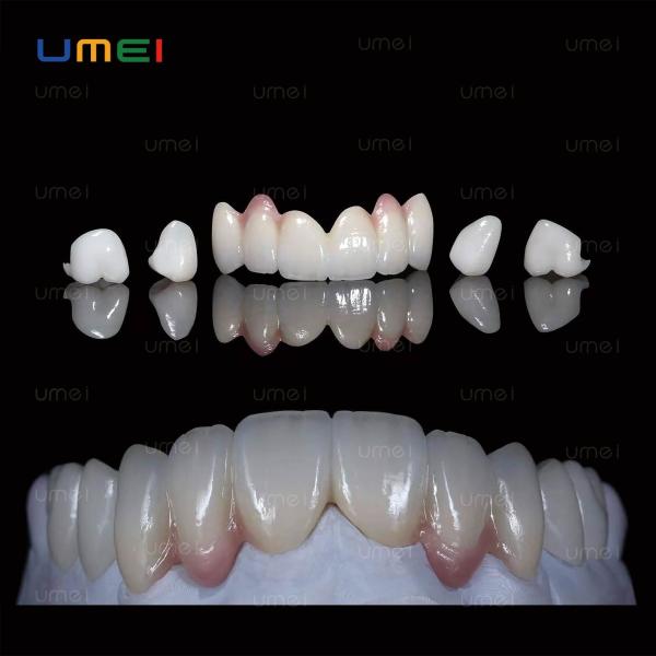 Quality Zirconia Fixed Partial Denture: A Dual Solution for Function and Aesthetics for sale