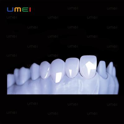 China Sirius Star Cut Dental Veneers-Minimally Invasive & Comfortable Experience-Digital Precision Customization for sale