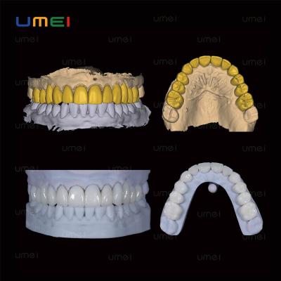 China Dental CAD Digital Restoration Workflow-Precision Manufacturing-Perfect Balance of Aesthetics and Function for sale