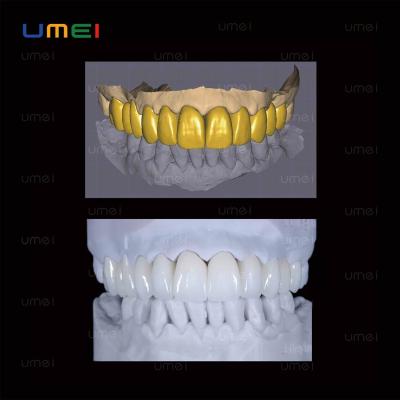 China Digital Dental Aesthetic Restoration Workflow-Precision Manufacturing-Aesthetic & Functional Balance for sale