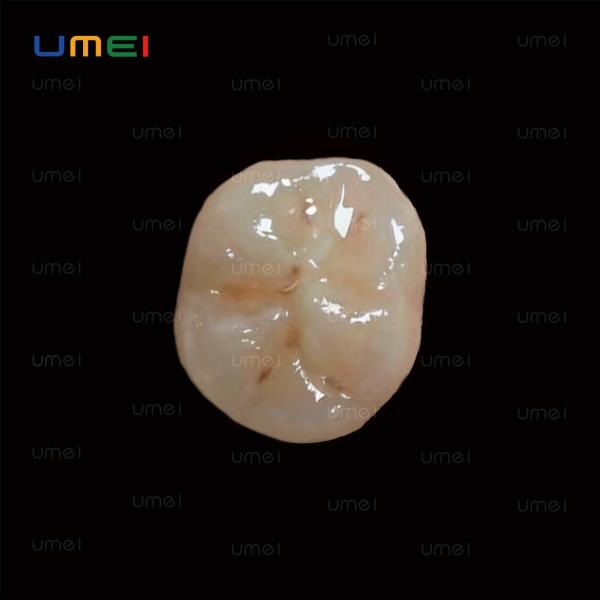 Quality Natural Aesthetic Dental Crown And Bridge High Transparency E.Max Crown for sale