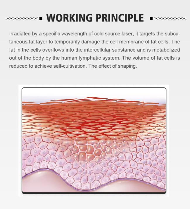laser working principle