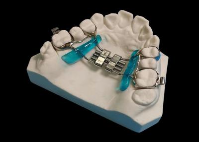 China Removable Expander for Effective Orthodontic Treatment and Smile Enhancement for sale