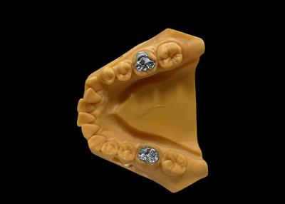 Cina Porcellana fusa al metallo PFM corona resistenza all'usura dentale per la odontoiatria restauratrice in vendita