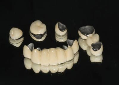 Cina Porcellana fusa al metallo PFM corona resistenza all'usura dentale per la odontoiatria restauratrice in vendita
