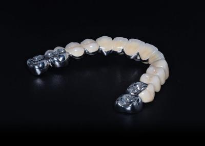 China Hoge duurzaamheid Biocompatibel porselein gesmolten met metalen kroon Precise fit Custom for sale