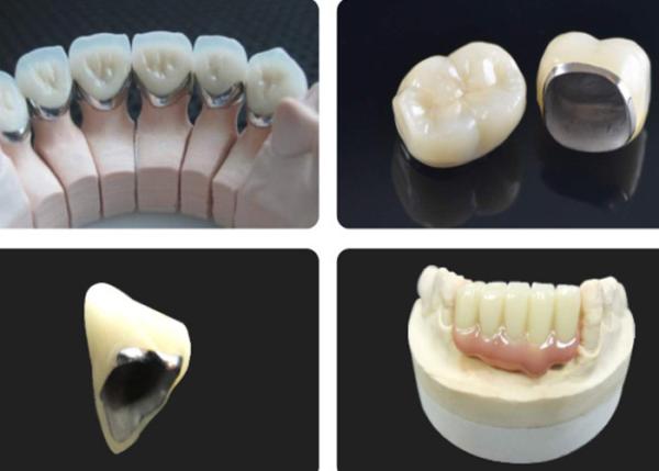 Quality Moderate Translucency Porcelain Fused To Metal PFM Crown , PFM Ceramic Crown for sale