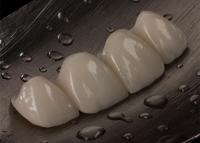 Quality Customizable Ceramic Crown Bridge For Missing Tooth Comfortable Perfect Fit for sale