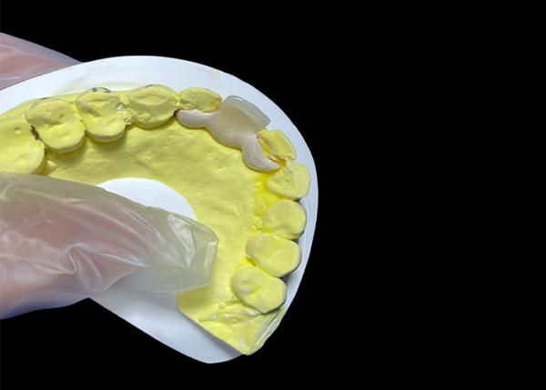 Quality Natural Looking Dental Ceramic Crown HPP Bonded Ceramic Bridge Easy Cleaning for sale