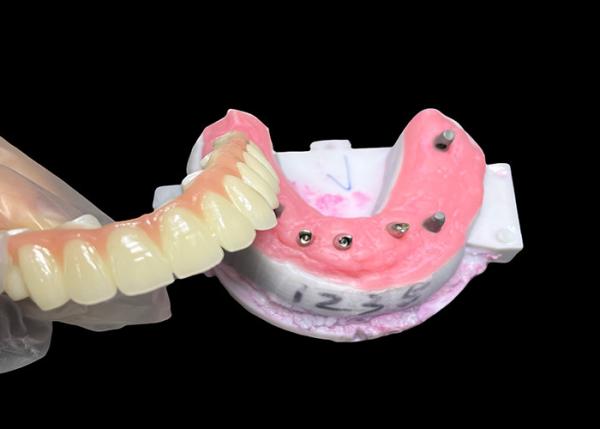 Quality Implant supported Full Arch Denture Fixed Dental implant Ceramic Crown Bridge for sale