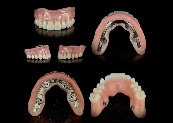 Quality Precise Bar Implant Supported Hybrid Denture Secure Fit Adjustable Stability for sale