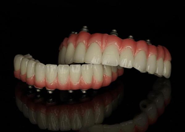 Quality Titanium Base Fixt Implant supported dentures with Ceramic Crown Bridge For for sale