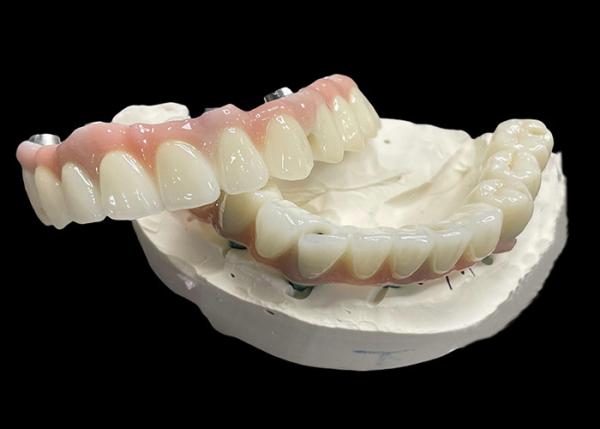 Quality Titanium Base Fixt Implant supported dentures with Ceramic Crown Bridge For for sale