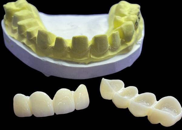 Quality Stain Resistant Dental Porcelain Crown Bridge , All Ceramic Bridges Vita Classical Shade for sale