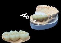 Quality Natural Color Zirconia Dental Crown Crack Resistant For A Flawless Smile for sale