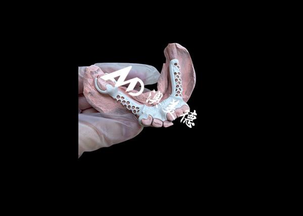 Quality Removable Denture with HPP Frame and Acrylic Base for Enhanced Durability and Comfort for sale