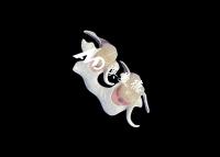 China Customized Hpp Frame Acrylic Removable Partial Denture For Missing Teeth for sale