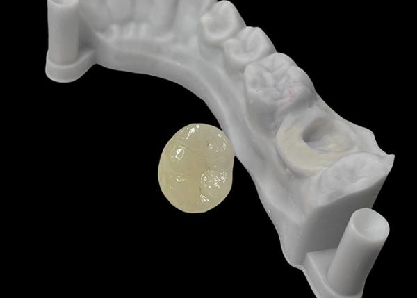 Quality Accurate Fit Dental Ceramic Inlays Onlays , Porcelain Inlays And Onlays FDA for sale