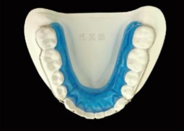 Quality Maintain Your Smile with Begg Retainer for Perfect Alignment and Long-Lasting for sale